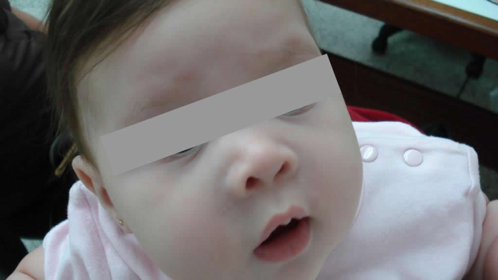 203 – Consulte a un colega Nº 3 – PIEL-L Latinoamericana