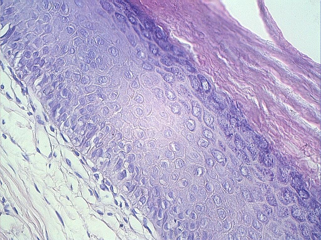 209-Consulta a un Colega Nº 4 – PIEL-L Latinoamericana