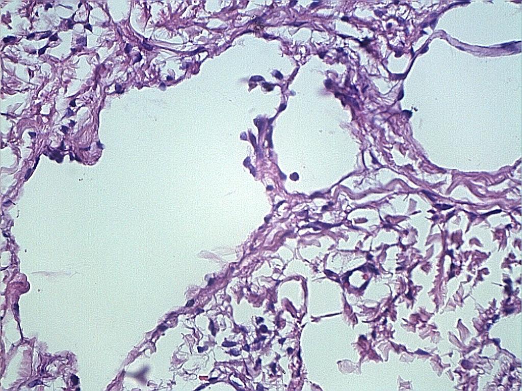 Consulta a un Colega N°4: Placa pápulo-vesiculosa de aspecto vascular ...