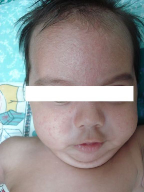 221 – CONSULTE A UN COLEGA Nº 4 – PIEL-L Latinoamericana