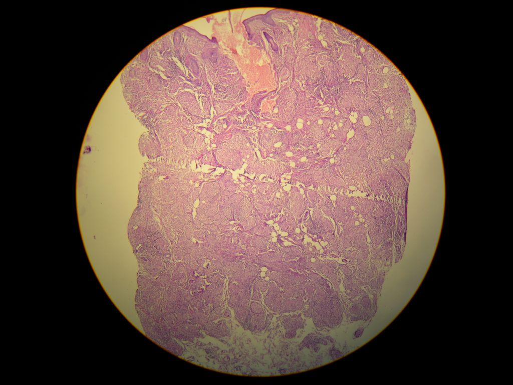 221 – CONSULTE A UN COLEGA Nº 1 – PIEL-L Latinoamericana