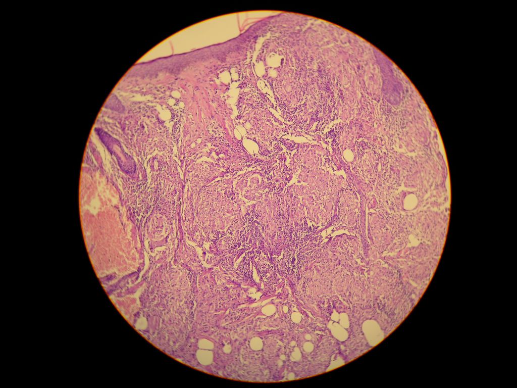 221 – CONSULTE A UN COLEGA Nº 1 – PIEL-L Latinoamericana