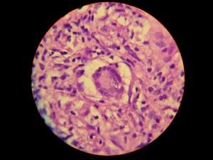 221 – CONSULTE A UN COLEGA Nº 1 – PIEL-L Latinoamericana