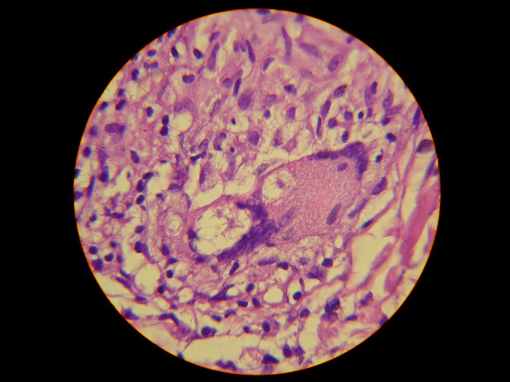 221 – CONSULTE A UN COLEGA Nº 1 – PIEL-L Latinoamericana