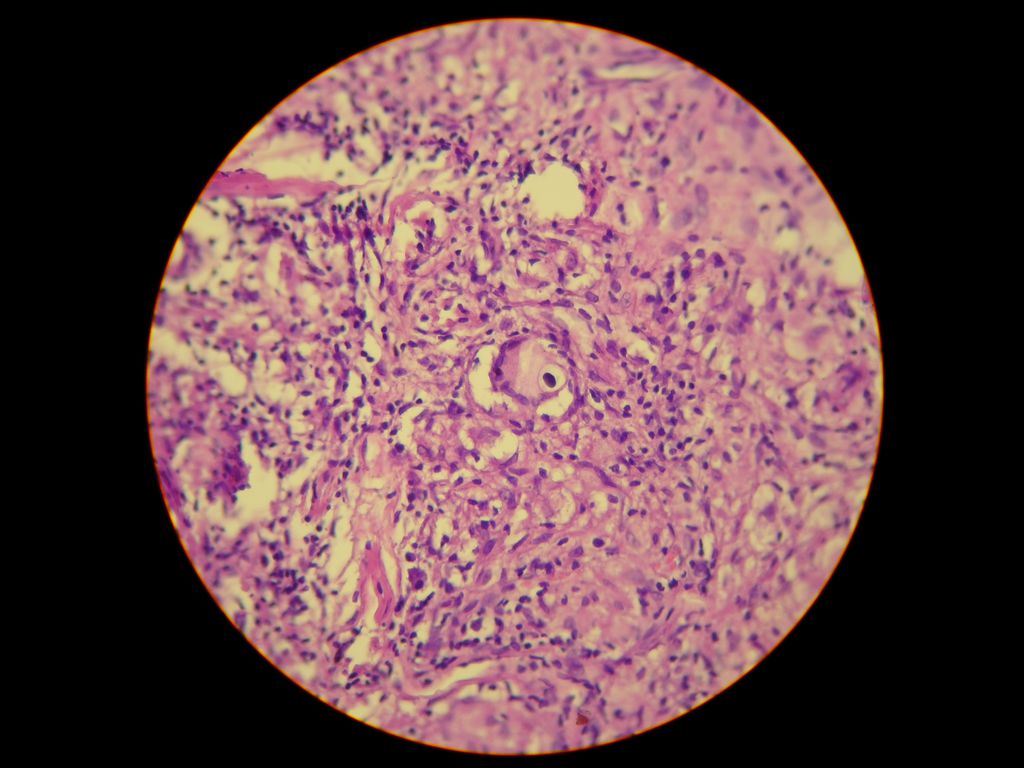 221 – CONSULTE A UN COLEGA Nº 1 – PIEL-L Latinoamericana