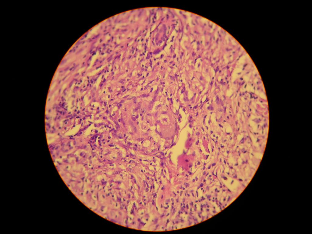 221 – CONSULTE A UN COLEGA Nº 1 – PIEL-L Latinoamericana