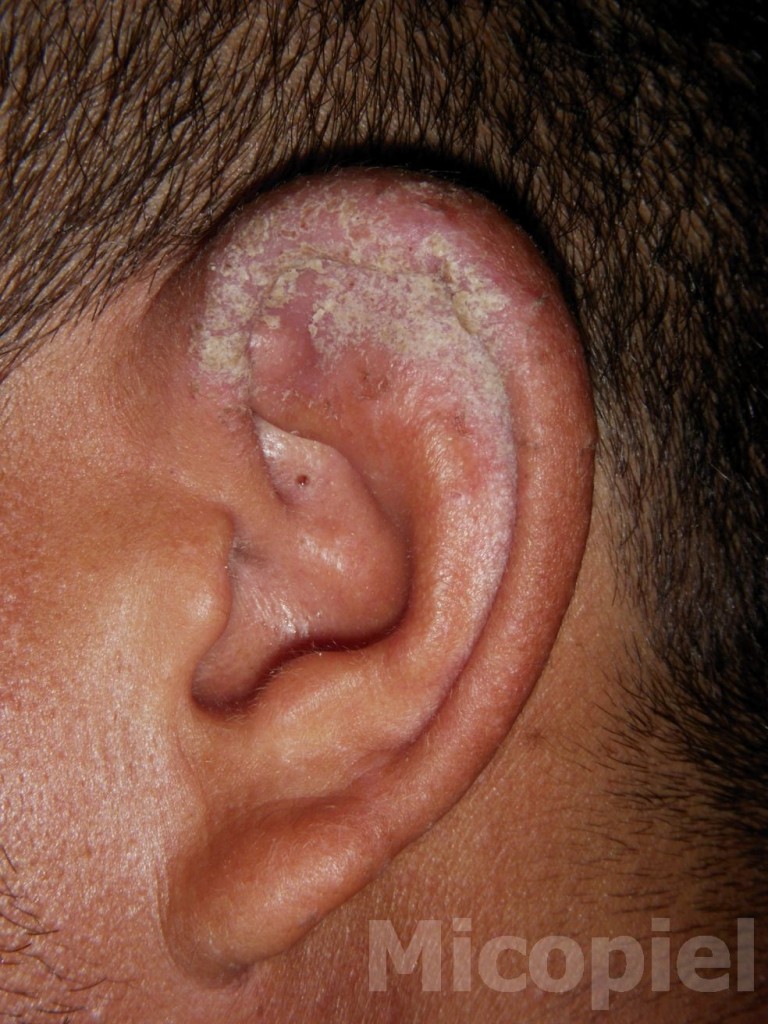 Casos para diagnósticos en Apéndices Auriculares y Áreas Peri ...