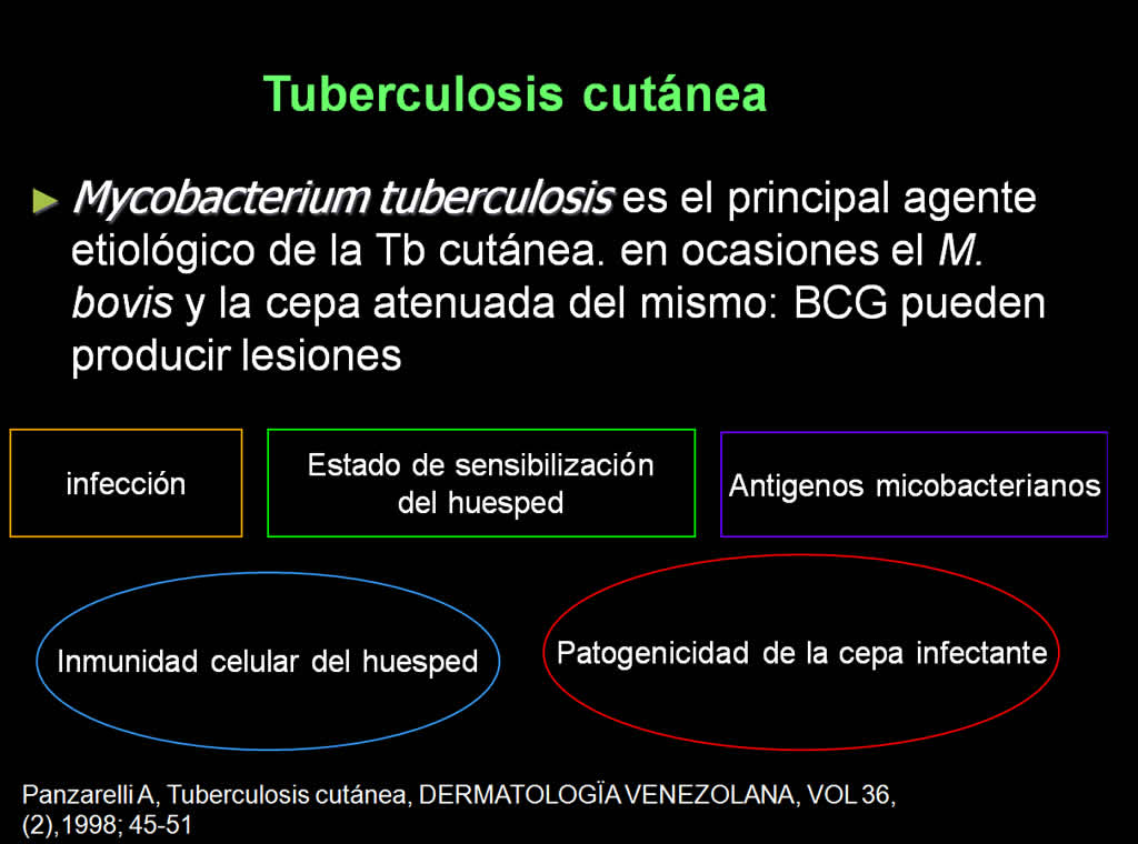 Tuberculosis Cutánea: Escrofuloderma – PIEL-L Latinoamericana