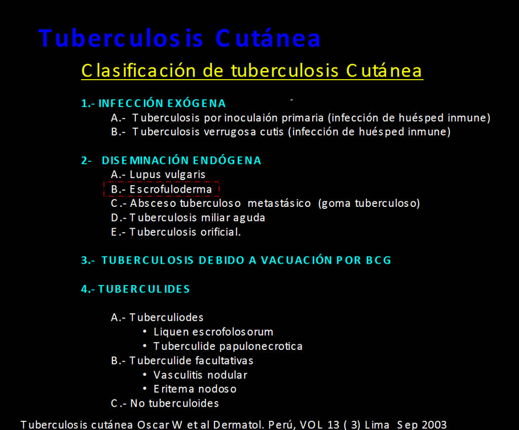 Tuberculosis Cutánea: Escrofuloderma – PIEL-L Latinoamericana