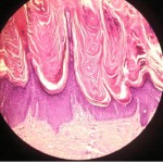 246 – Consulta a un Colega Nº 4: ¿Genodermatosis? – PIEL-L Latinoamericana