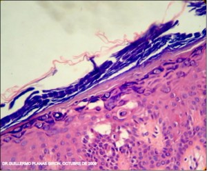 foto 6 – PIEL-L Latinoamericana