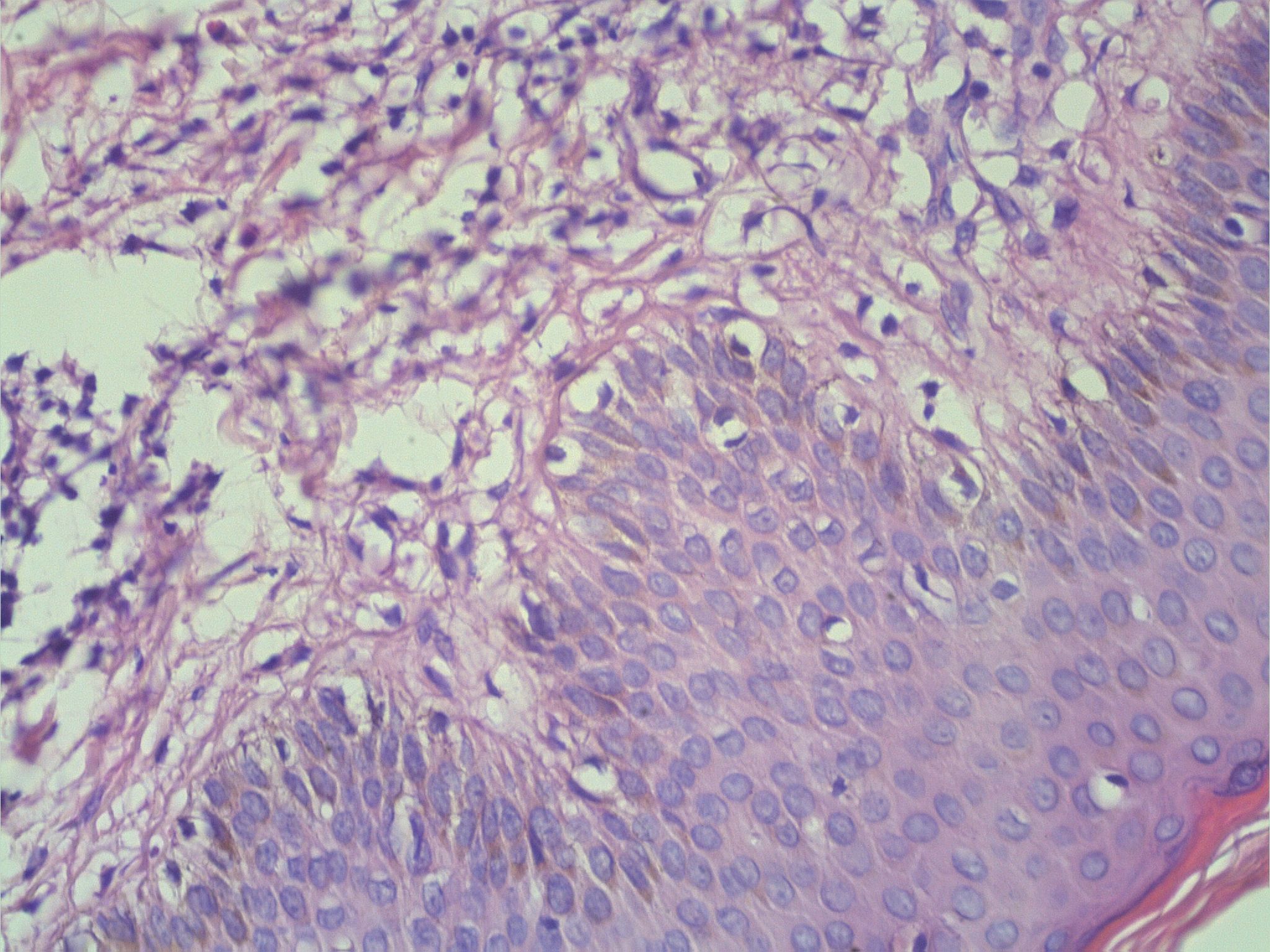 255 – Consulta a un Colega Nº1: Placa eritematosa, localizada en piel ...