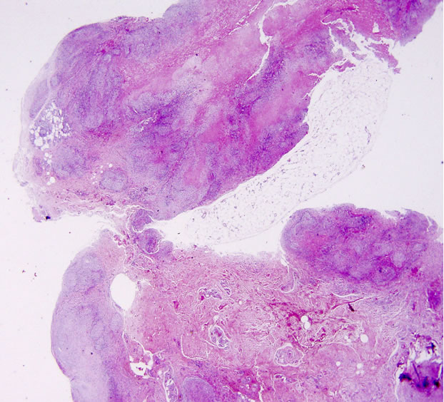 Caso de SILADEPA Edición 256 – PIEL-L Latinoamericana