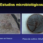Botriomicosis – PIEL-L Latinoamericana