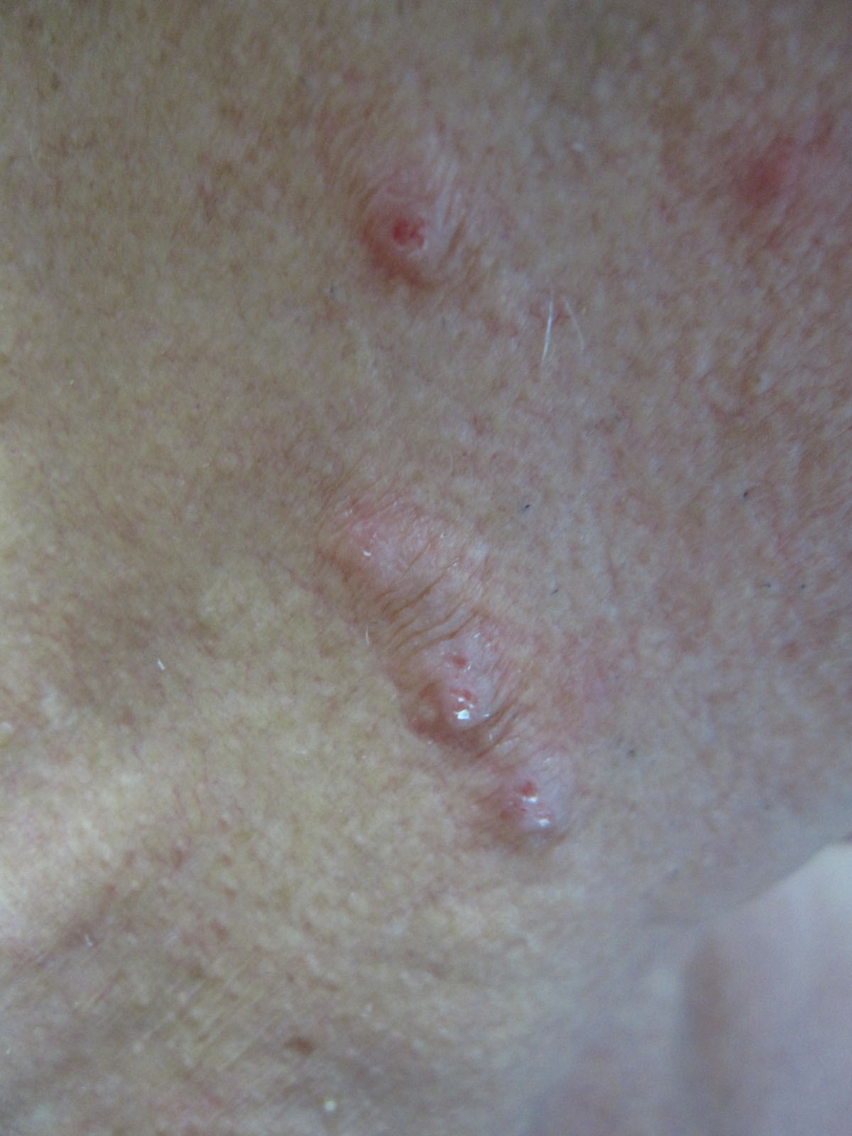 ¿Qué Piensa Usted? Nº3 Edición 265: Lesiones en cuello, nodulares ...