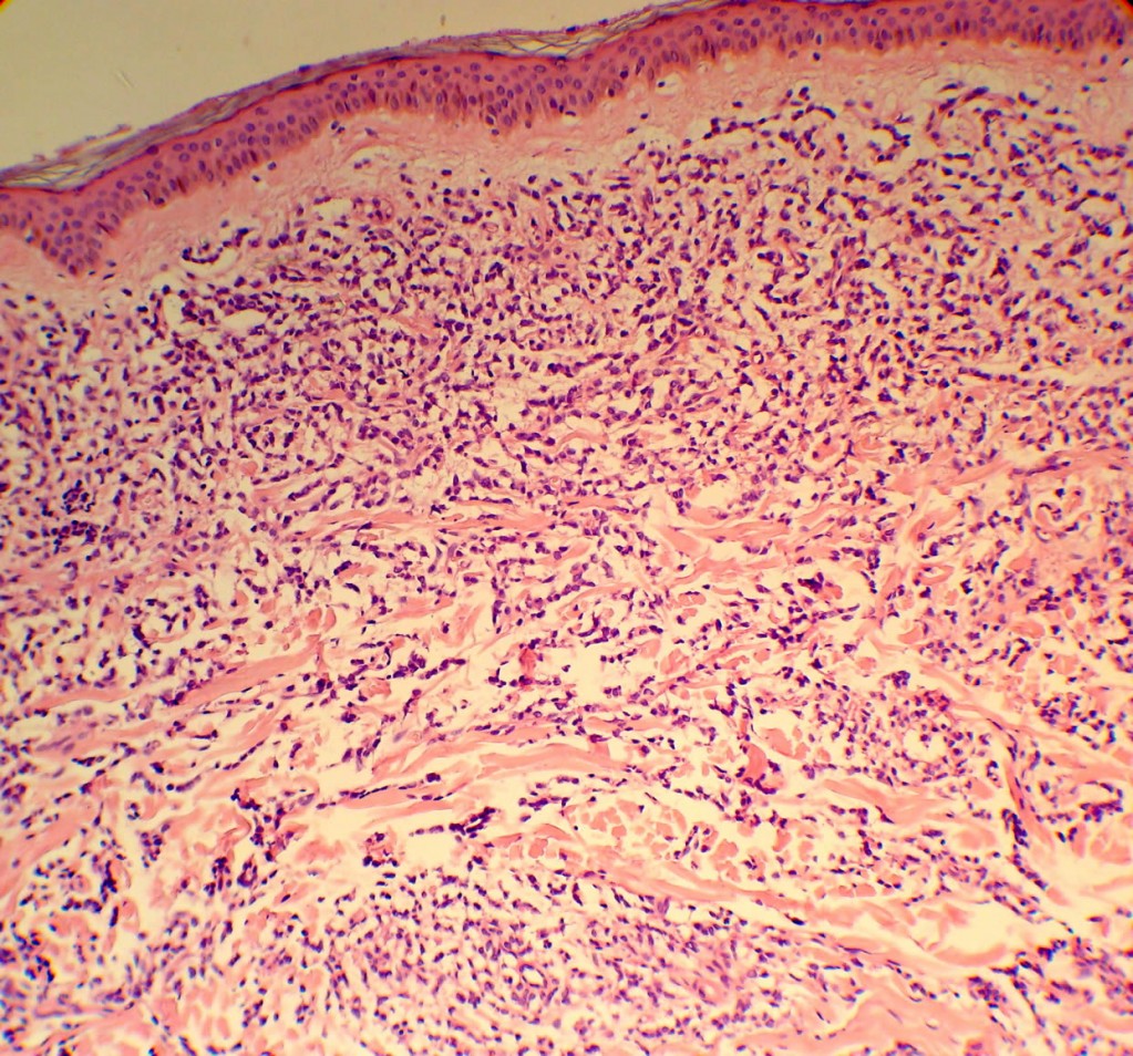 FOTO N 2 – PIEL-L Latinoamericana