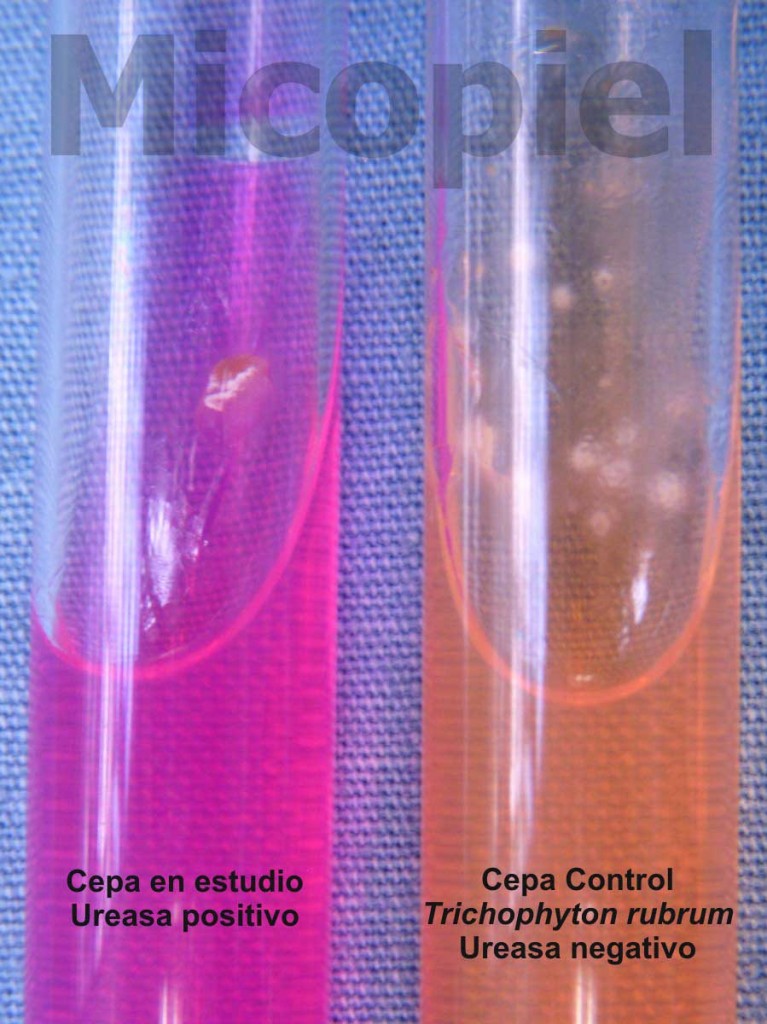 Caso clínico Nº 45. Tinea corporis – PIEL-L Latinoamericana