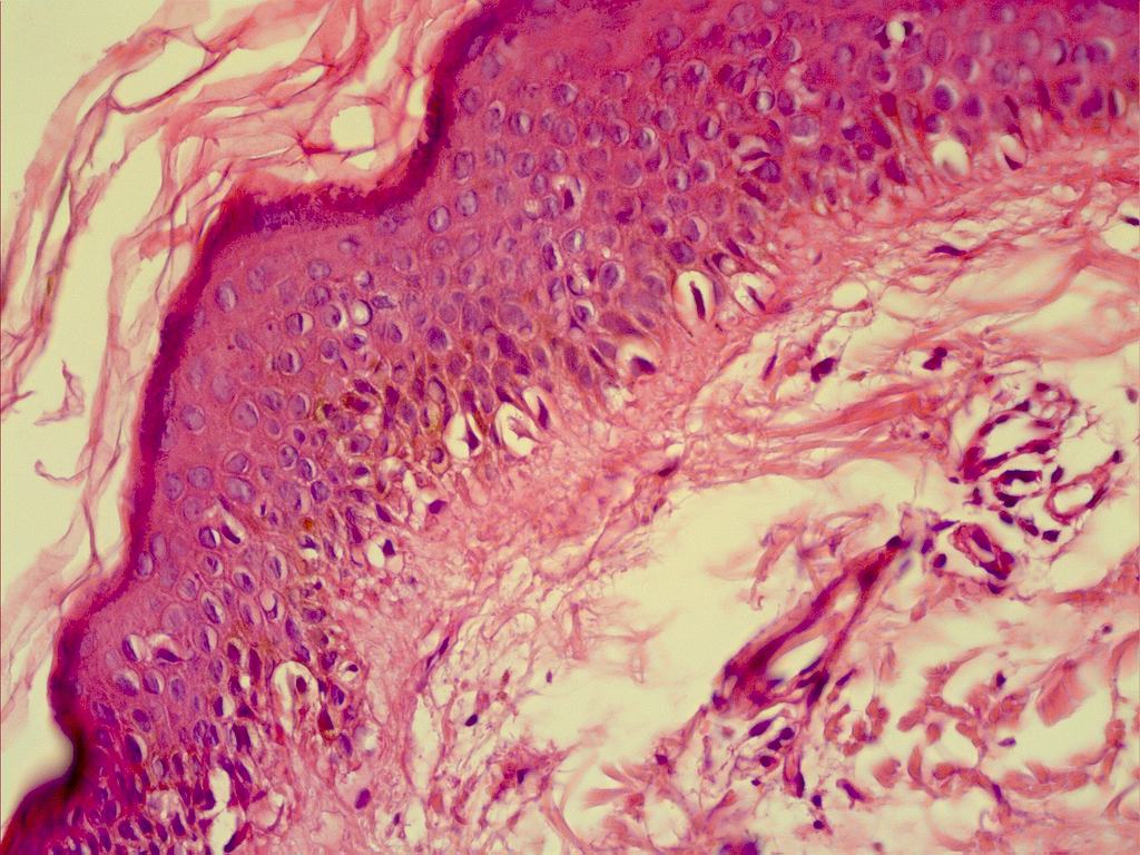 Consulta a un Colega Nº3 Edición 266: placas eritematosas localizadas ...