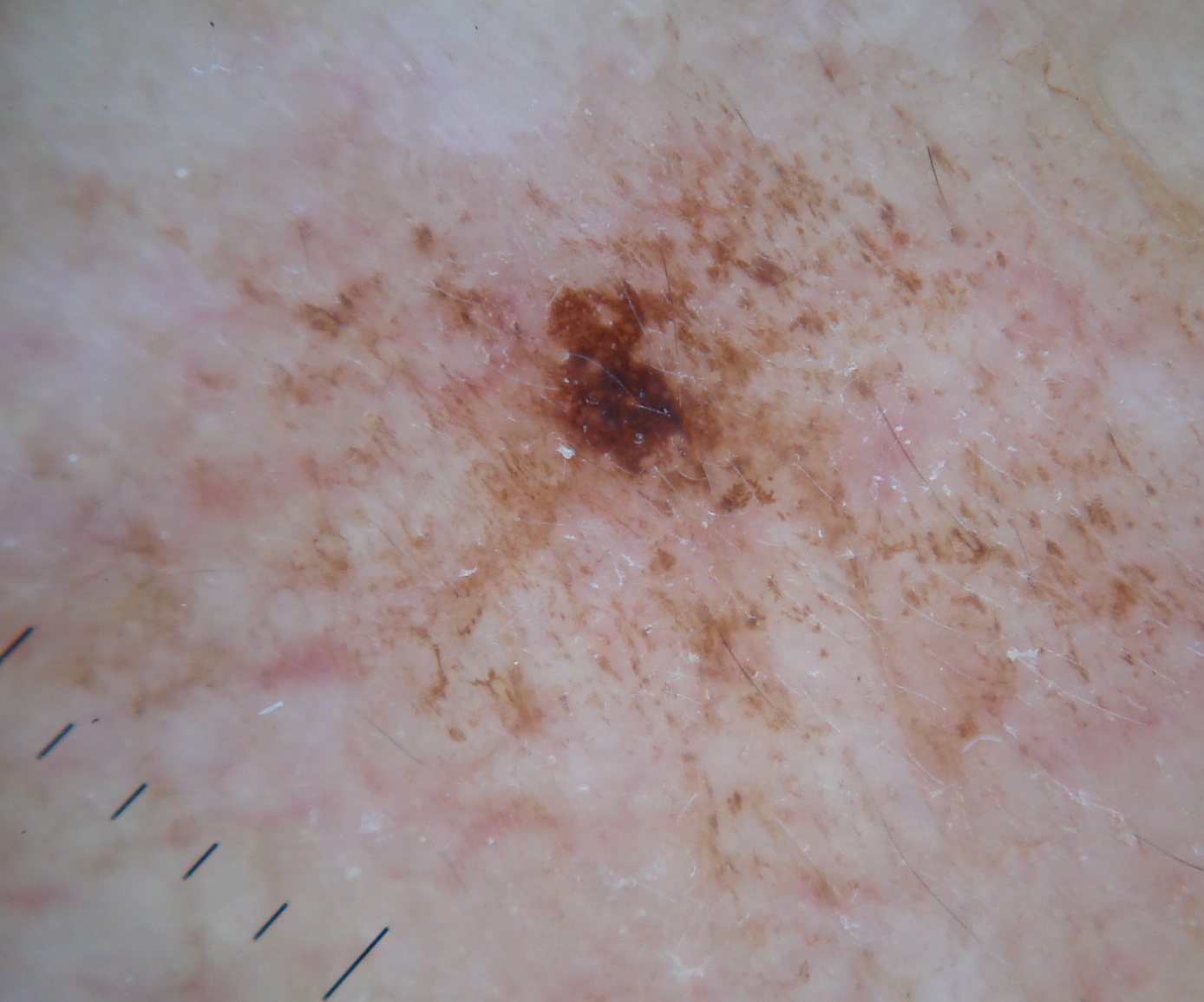 Dermatoscopia Edición 268 – PIEL-L Latinoamericana