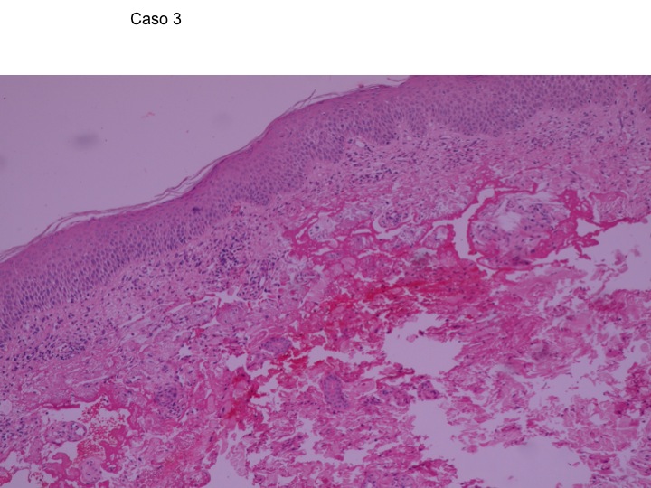¿Qué piensa Usted? Nº1 Edición 270: Tres pacientes con SIDA, Hay que ...