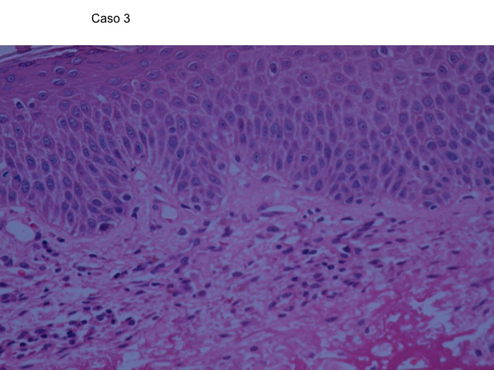 ¿Qué piensa Usted? Nº1 Edición 270: Tres pacientes con SIDA, Hay que ...