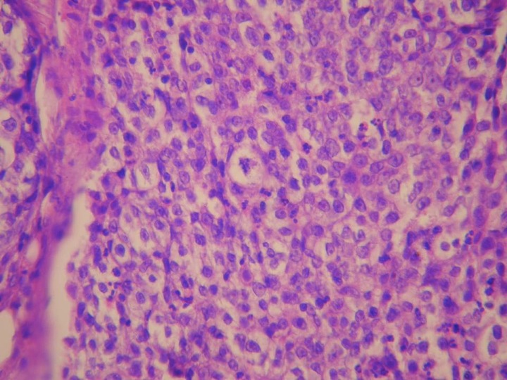 CASO N 7. Caso Clinico-Patologico para el Foro Dermatopatologico – PIEL ...