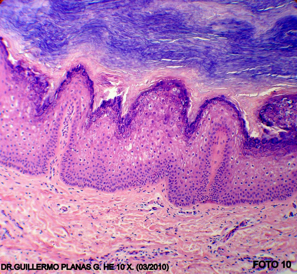 FOTO-10 – PIEL-L Latinoamericana