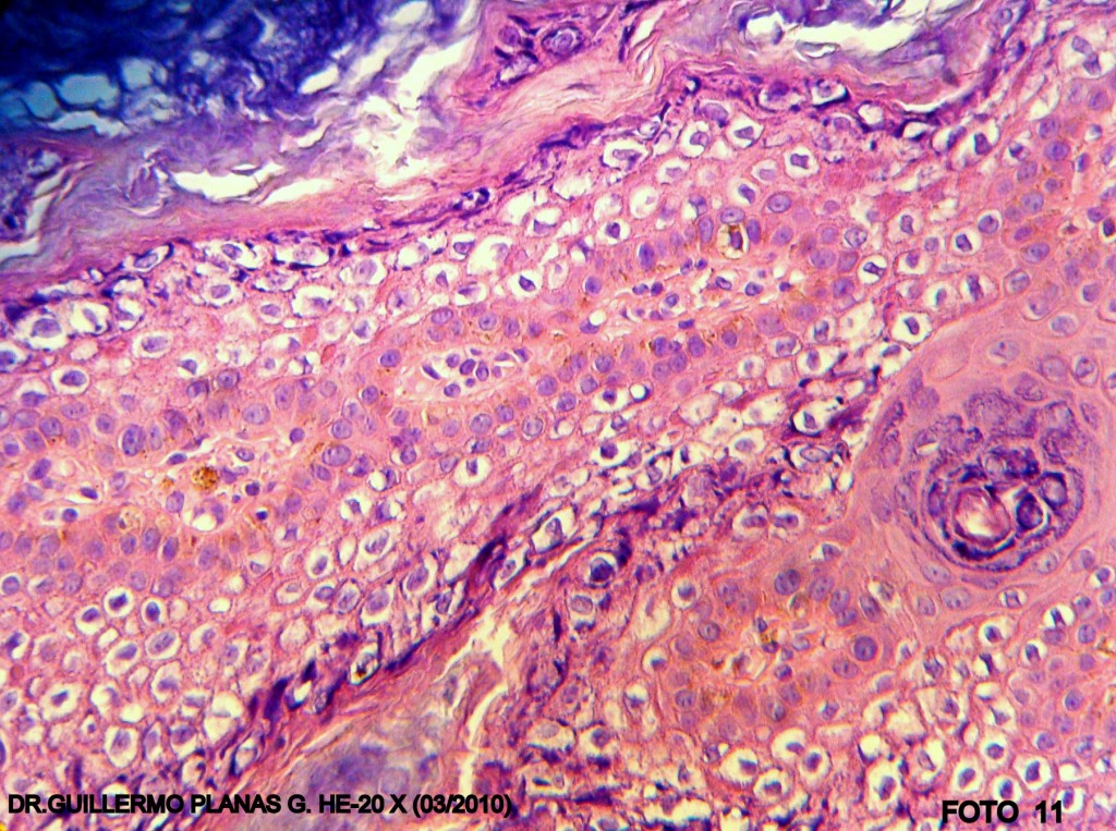 FOTO-11 – PIEL-L Latinoamericana