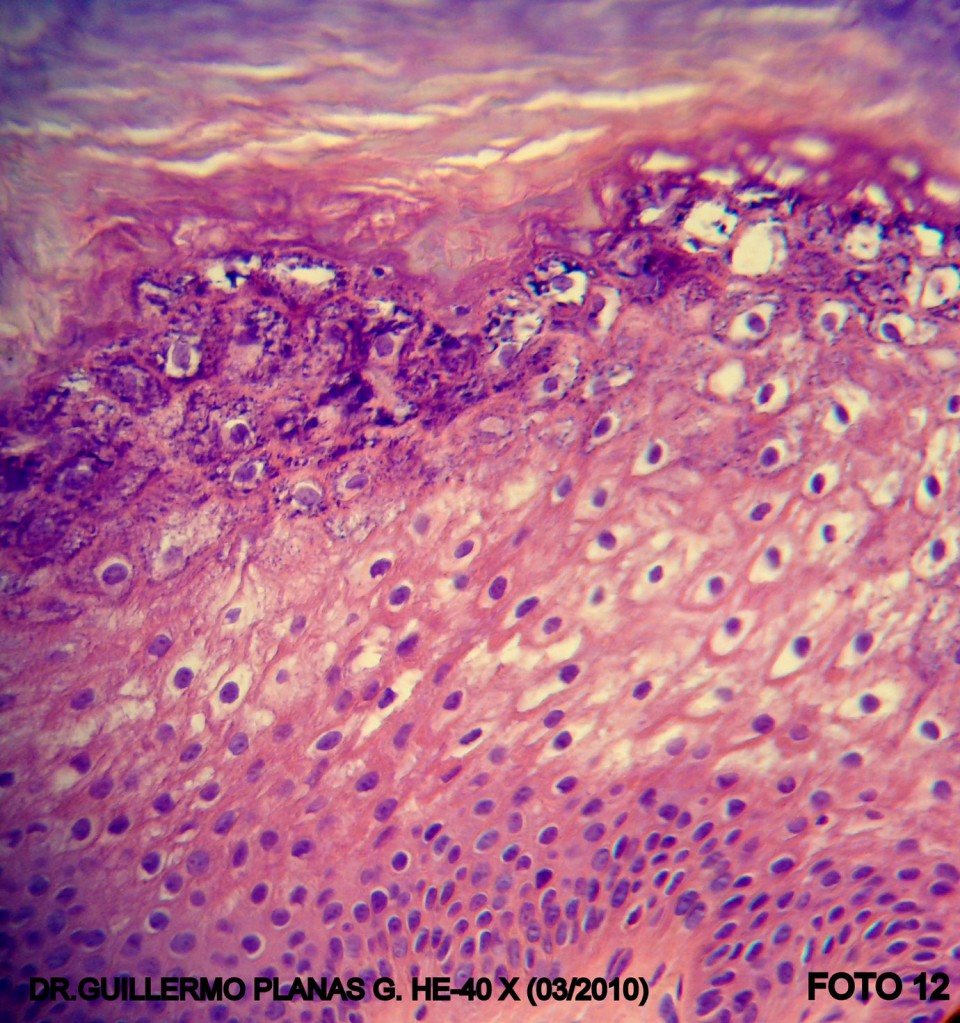 FOTO-12 – PIEL-L Latinoamericana