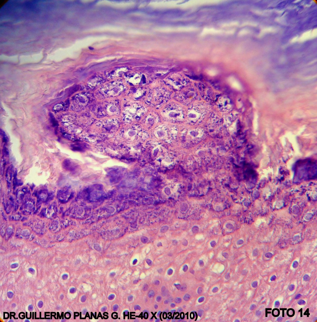 FOTO-14 – PIEL-L Latinoamericana