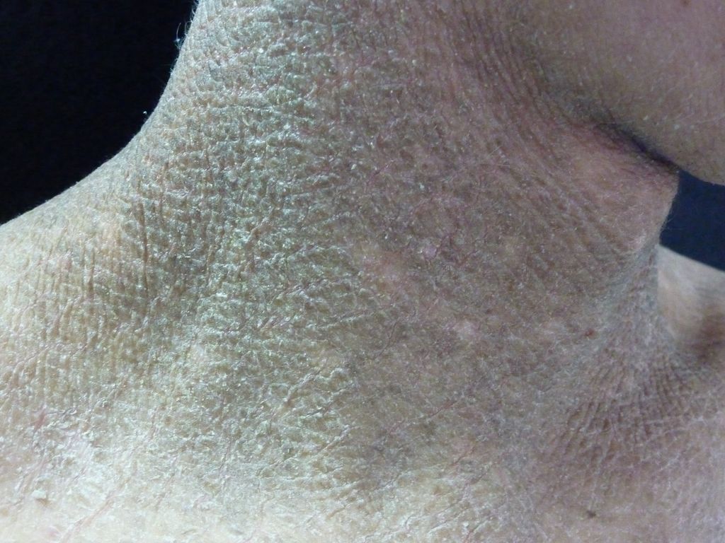 Consulta a un Colega Nº2 Edición 277: Dermatosis desde el nacimiento ...