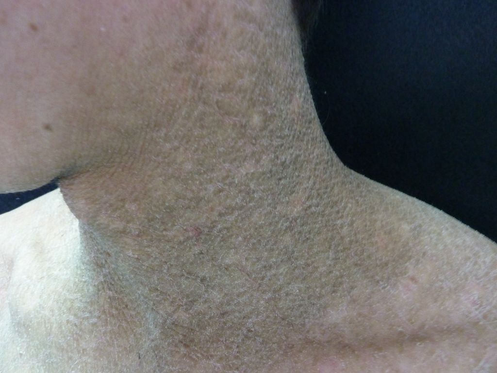 Consulta a un Colega Nº2 Edición 277: Dermatosis desde el nacimiento ...