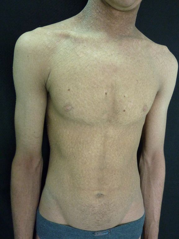 Consulta a un Colega Nº2 Edición 277: Dermatosis desde el nacimiento ...