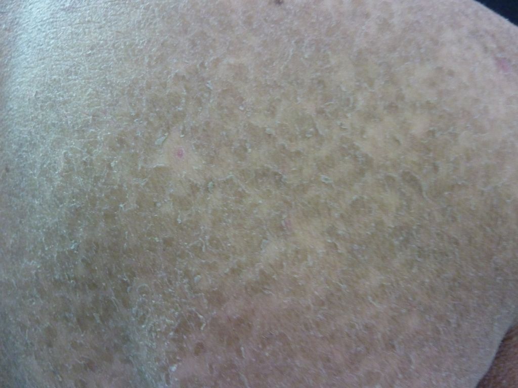 Consulta a un Colega Nº2 Edición 277: Dermatosis desde el nacimiento ...