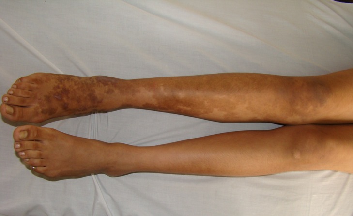 Close-Up 283 – PIEL-L Latinoamericana