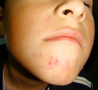 Close-Up Edición 300 – PIEL-L Latinoamericana