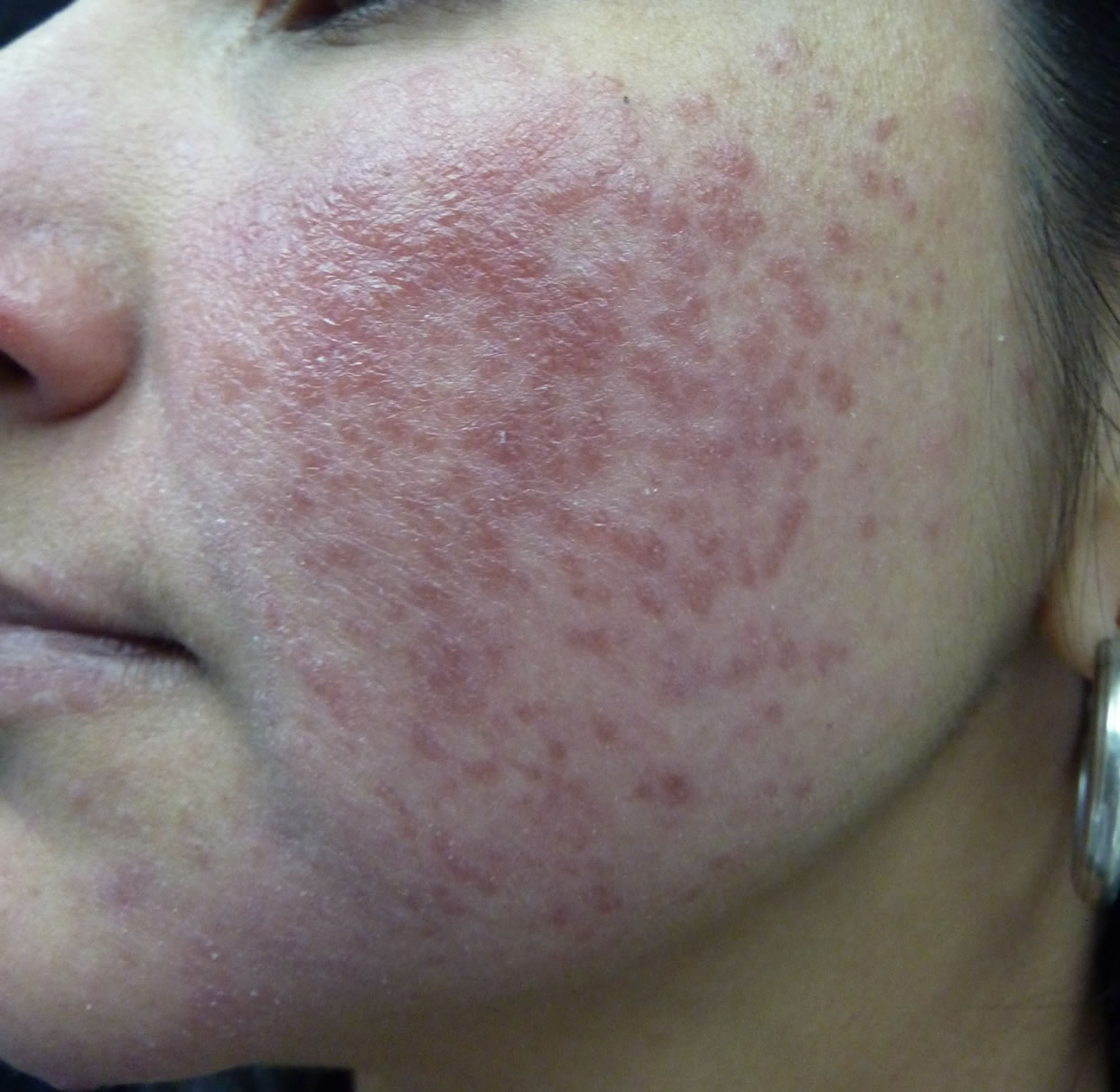 P1030982 – PIEL-L Latinoamericana