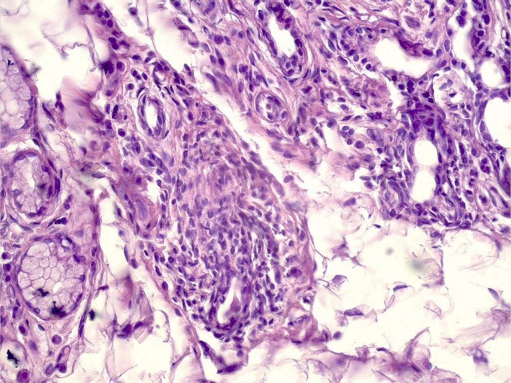 image648 – PIEL-L Latinoamericana