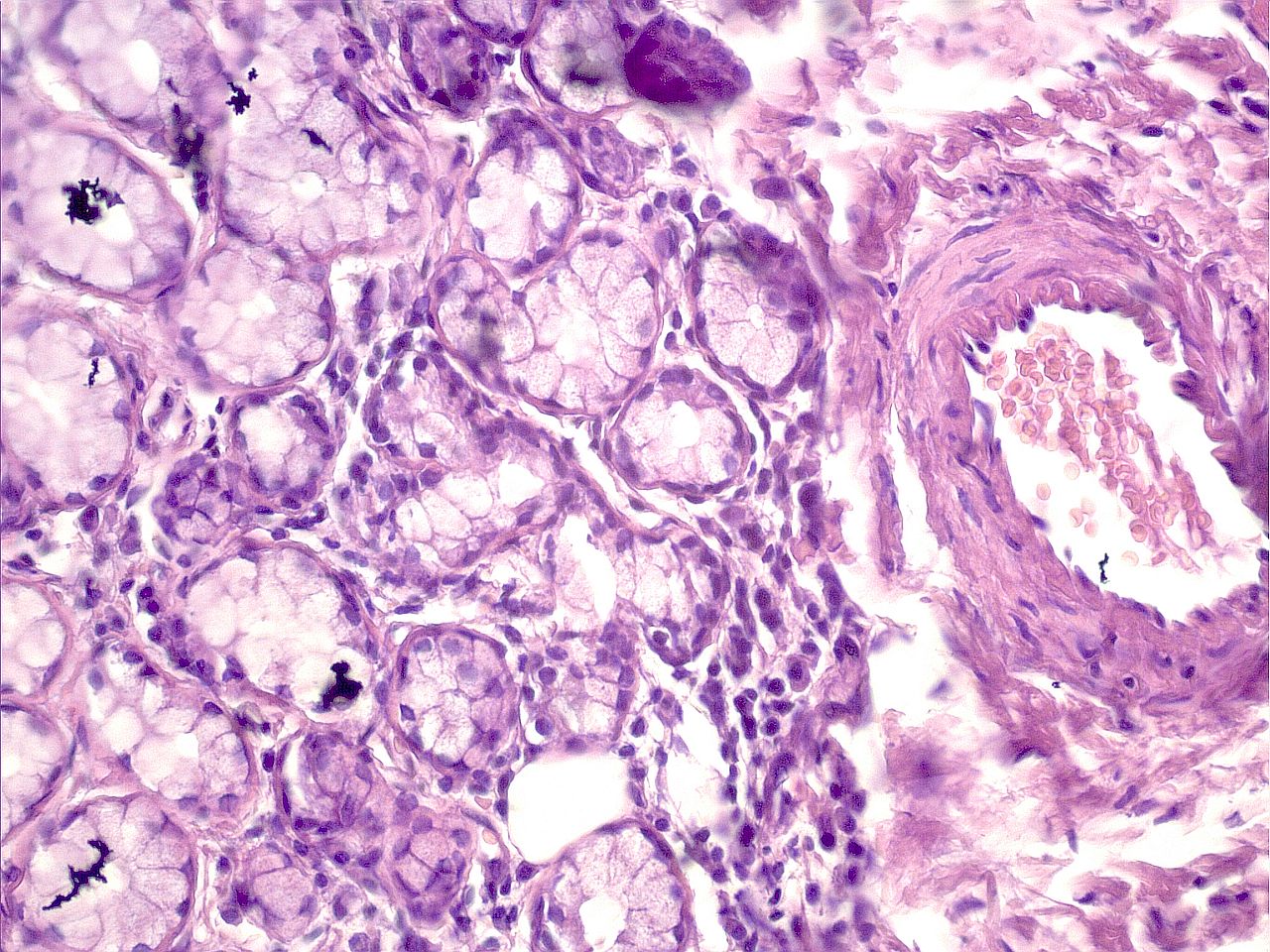 image649 – PIEL-L Latinoamericana