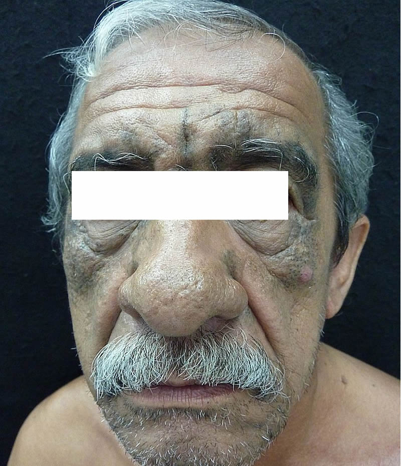 Dermatocosmética Ed.336 – PIEL-L Latinoamericana