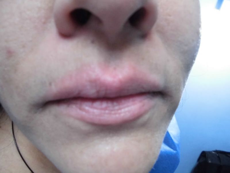 Sección Interactiva – Página 5 – PIEL-L Latinoamericana