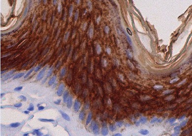 Lo mejor de la investigación dermatológica en 2013 – PIEL-L Latinoamericana