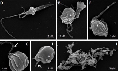 El inhibidor de calpaína MDL28170 induce apoptosis en Leishmania ...