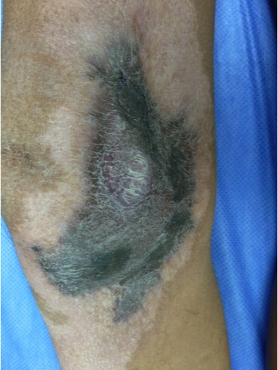 Dermatocosmética Ed.354 – PIEL-L Latinoamericana
