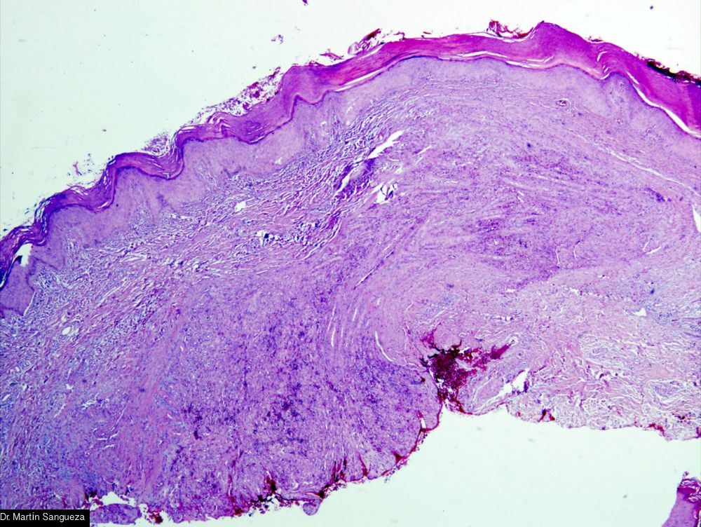 Siladepa Nº 12 – PIEL-L Latinoamericana
