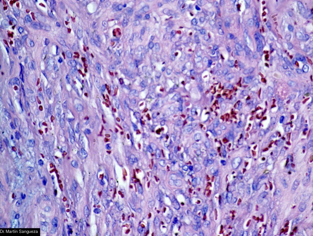 Siladepa Nº 12 – PIEL-L Latinoamericana