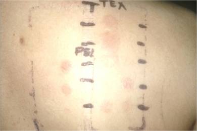 Tatuajes temporales con henna y componentes sensibilizantes – PIEL-L ...