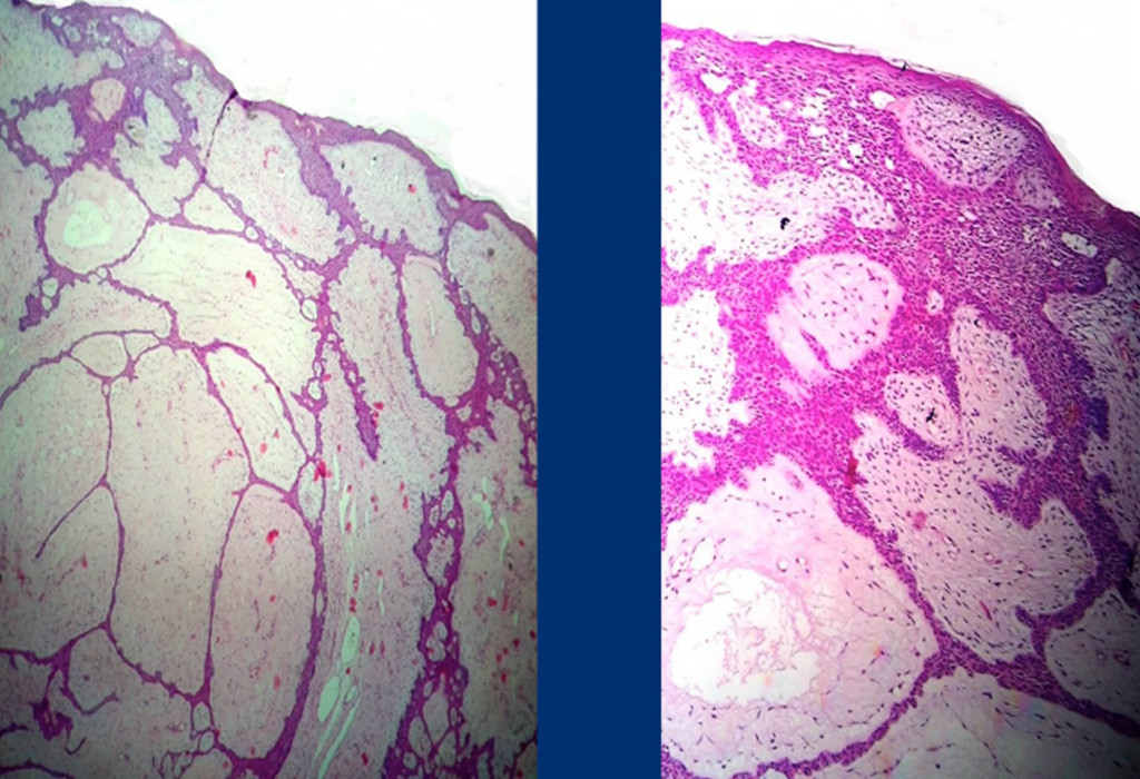 Casos para diagnóstico Ed.365 – PIEL-L Latinoamericana