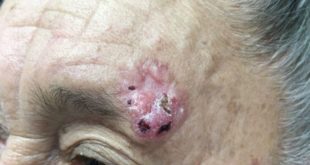 El escalpelo de la piel – PIEL-L Latinoamericana