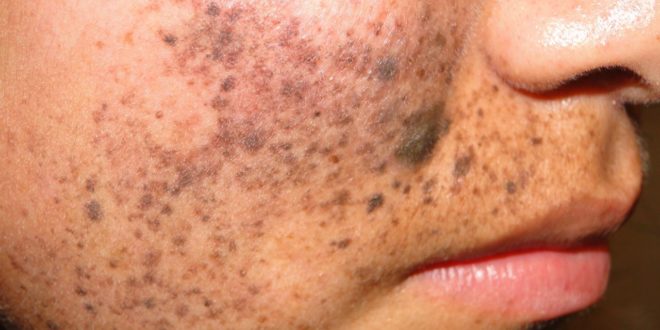 Close-Up Nº 395 – PIEL-L Latinoamericana